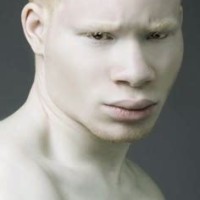 The Whitest People On Earth | List Of White People By Country – FOURNR
